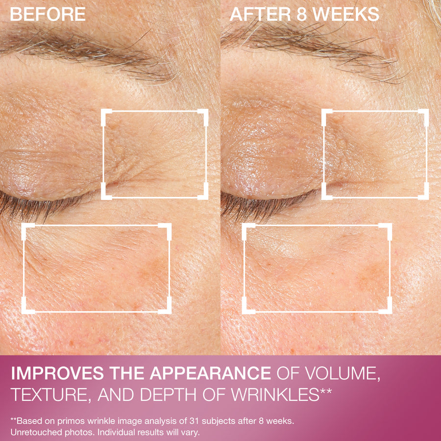 Advanced Retinol