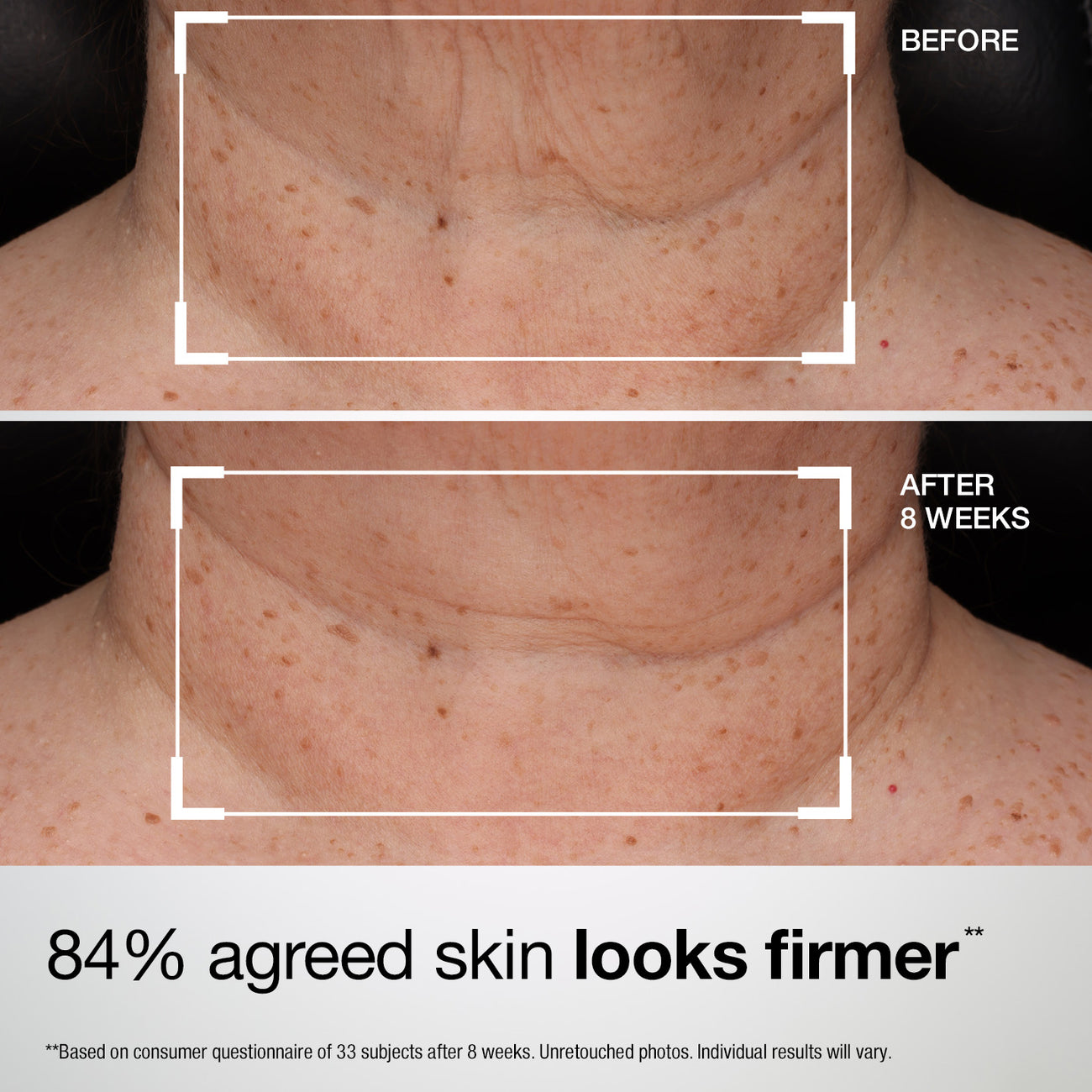 Neck Care