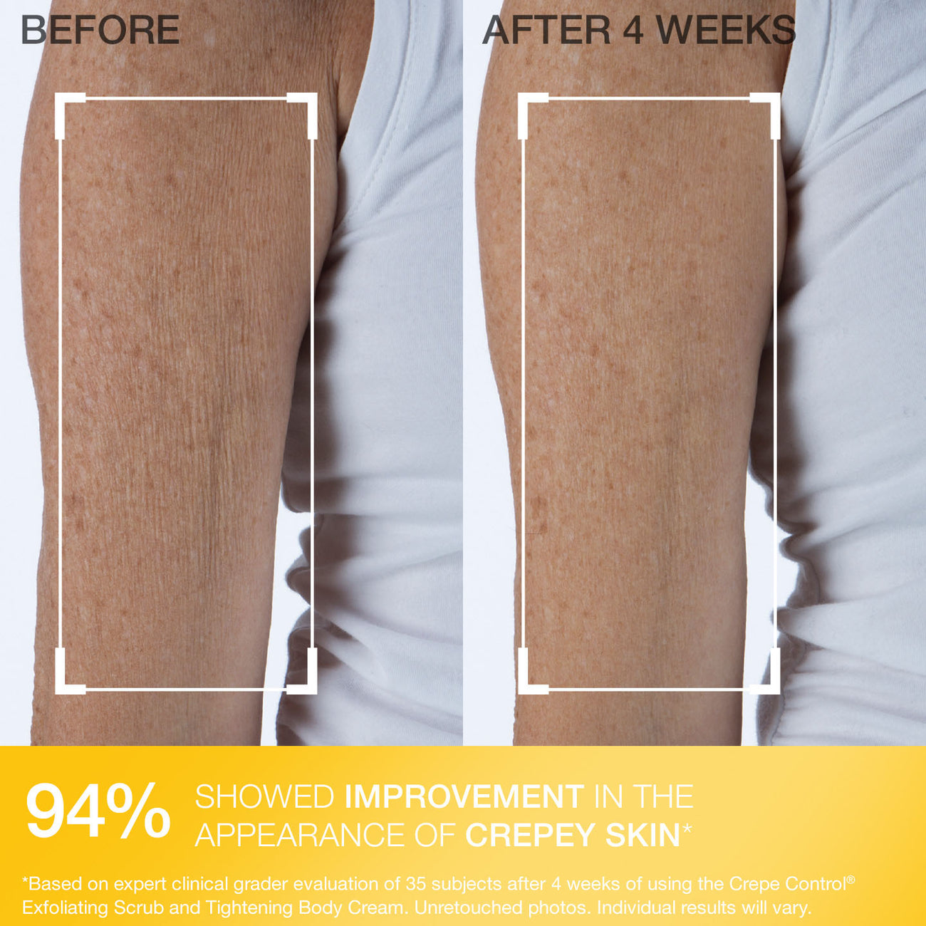 Official Site | Anti-Aging Innovations | Strivectin US